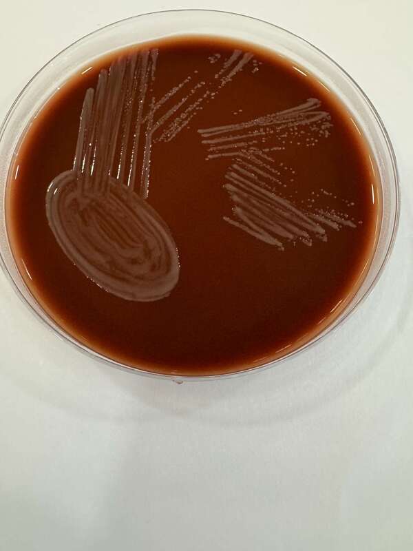 Chocolate Agar (GC Medium) Plate